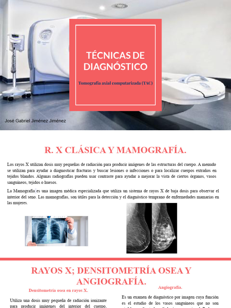 Trabajo-Técnicas de Diagnóstico (TAC) | PDF | Angiografía | Ct Scan