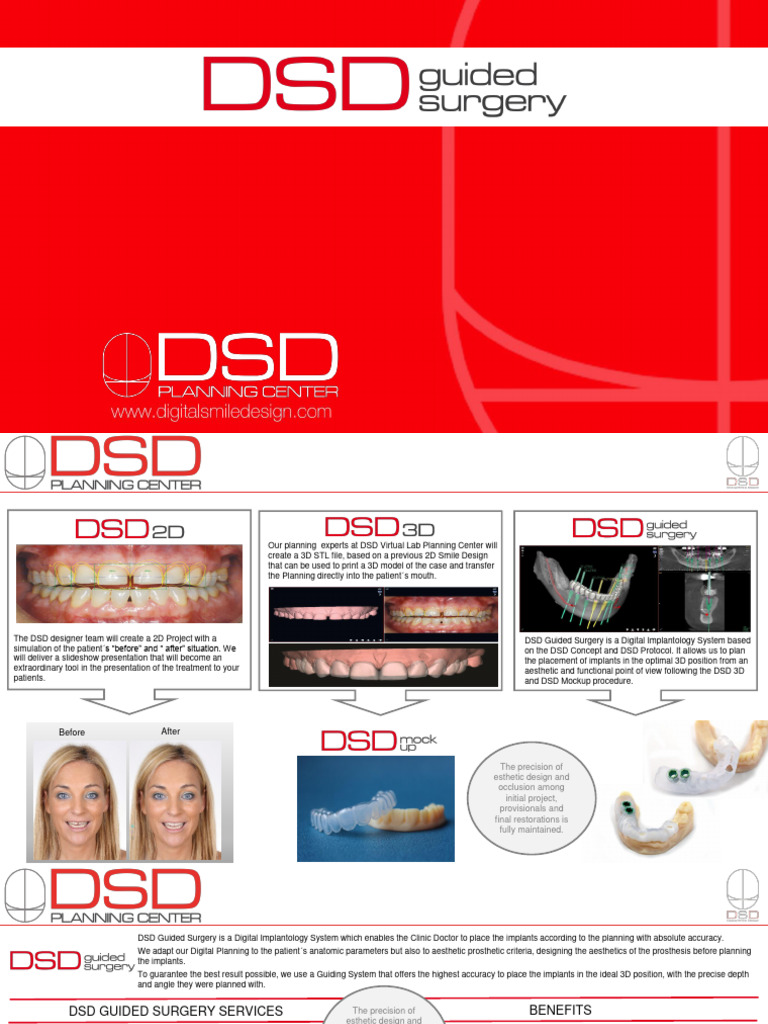 DSD Guia | PDF | Dental Implant | Medical Specialties