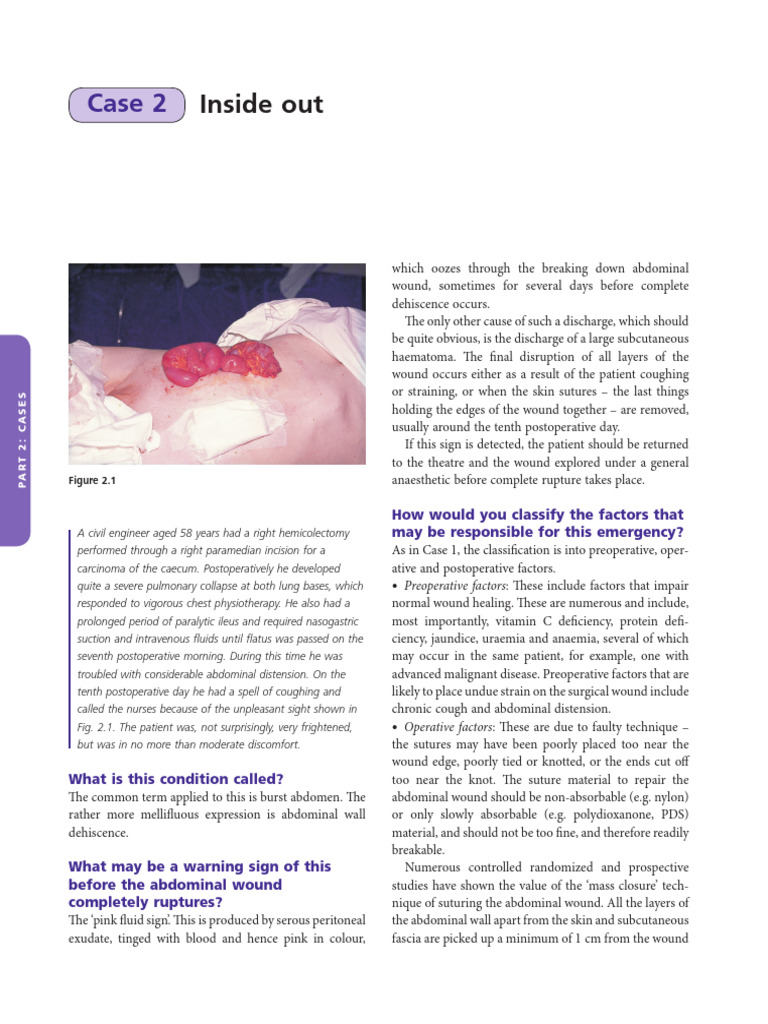 Case 002 | Download Free PDF | Surgical Suture | Abdomen
