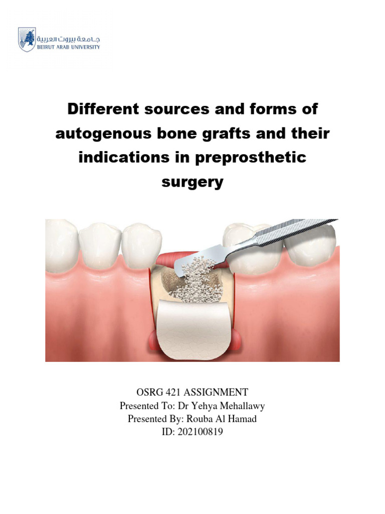 Autogenous Bone Grafts in Dentistry | PDF | Dental Implant | Bone