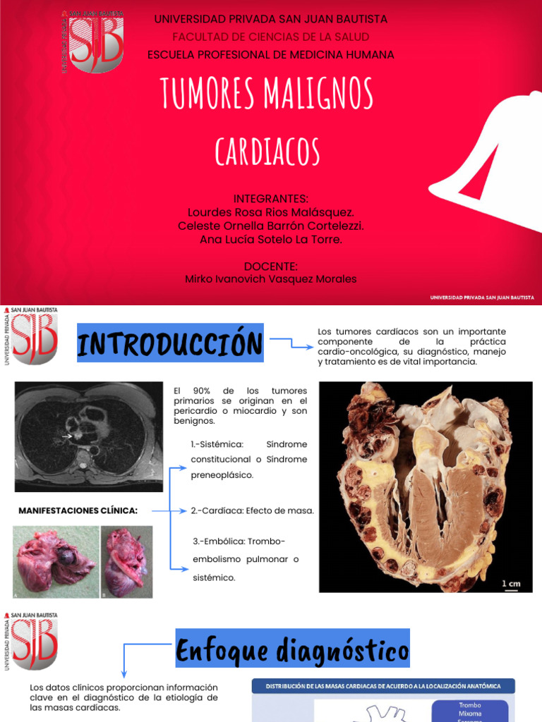 Tumores Malignos Cardiacos | PDF | Metástasis | Sarcoma