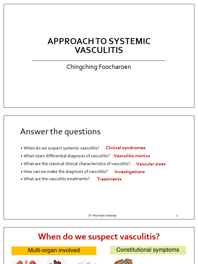 Approach To Systemic Vasculitis - Print Version | PDF | Immunology | Medical Specialties