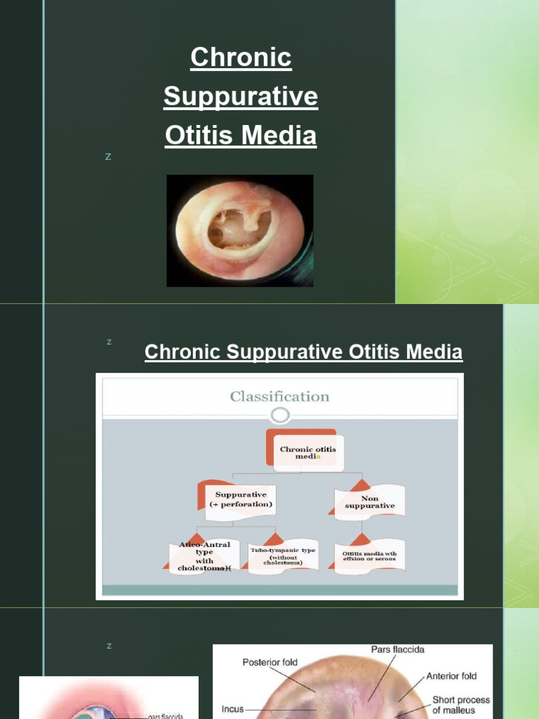 Ear Chronic | PDF | Ménière's Disease | Hearing Loss