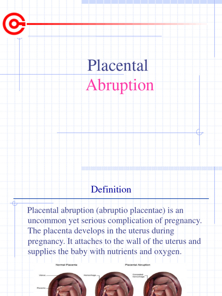 Placental Abruption | PDF | Childbirth | Uterus