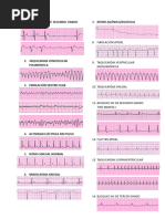 Preguntas RCP ACLS | PDF | Reanimación cardiopulmonar | Electrofisiología cardíaca