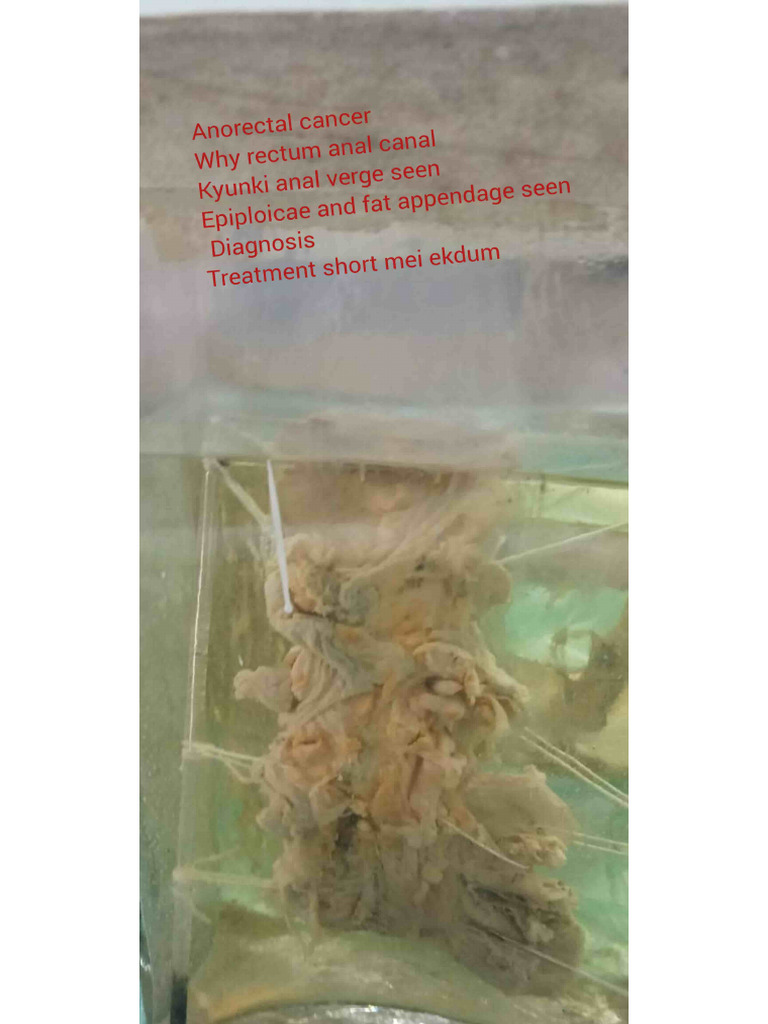 Surgery Specimen | PDF
