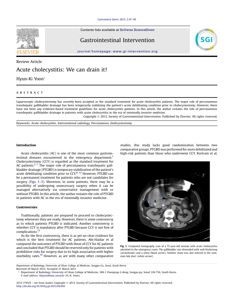 Acute Cholecystitis We Can Drain It | PDF | Gastroenterology | Medicine