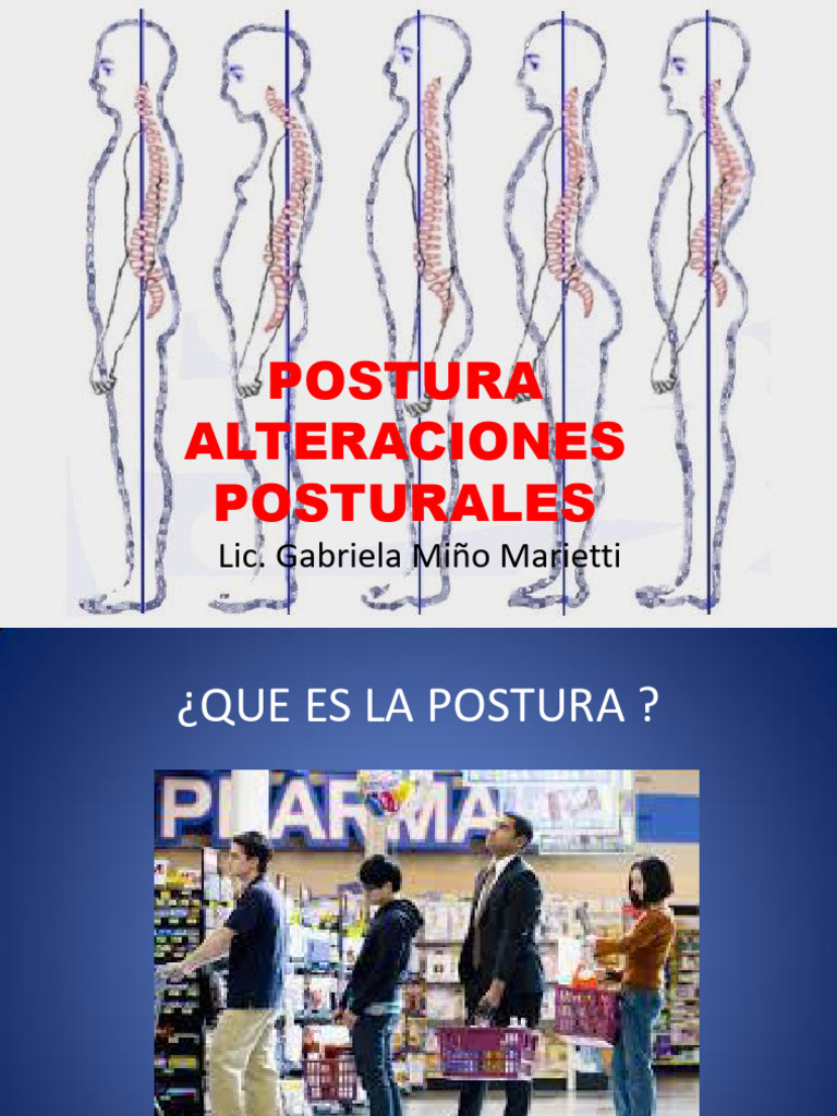 Alteraciones Posturales y Postura Antálgica | PDF | La columna ...