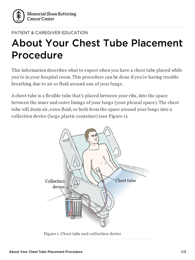 about-your-chest-tube-placement | PDF | Thorax | Lung