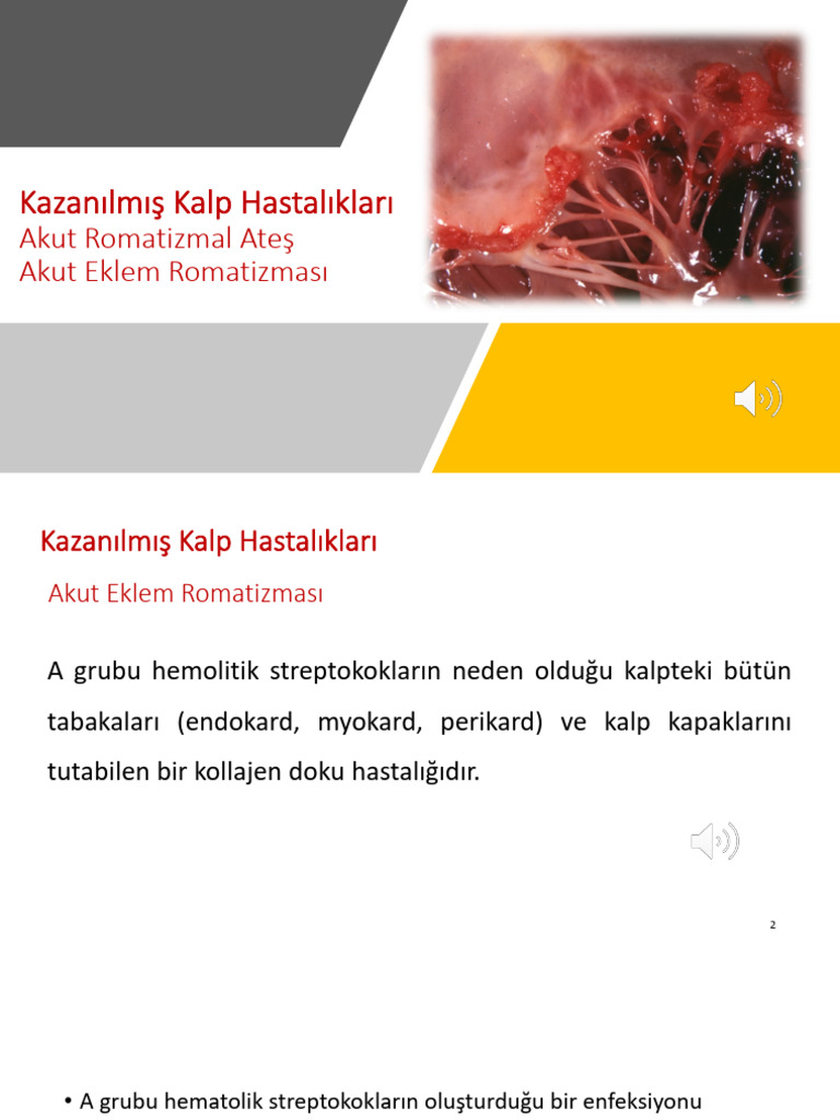 3 Eee | PDF