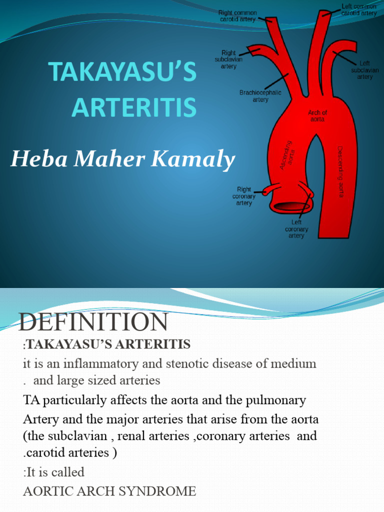 Takayasu's Arteritis HH | PDF | Aorta | Magnetic Resonance Imaging