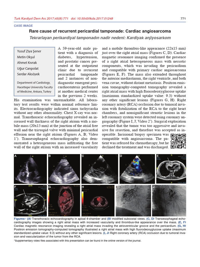 Rare Cause of Recurrent Pericardial Tamponade: Cardiac Angiosarcoma ...
