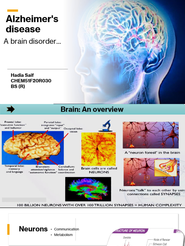 Alzheimer's Disease PPT Slideshare | PDF