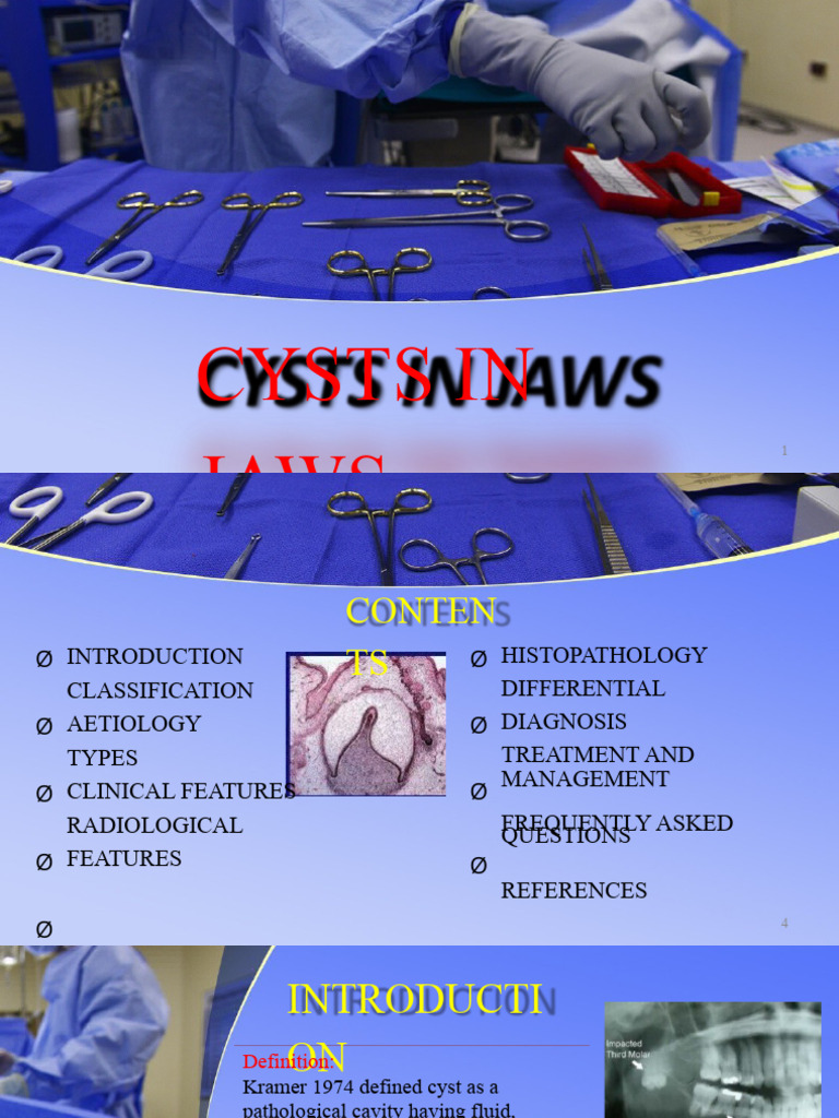 Cysts PDF | PDF | Epithelium | Medical Specialties