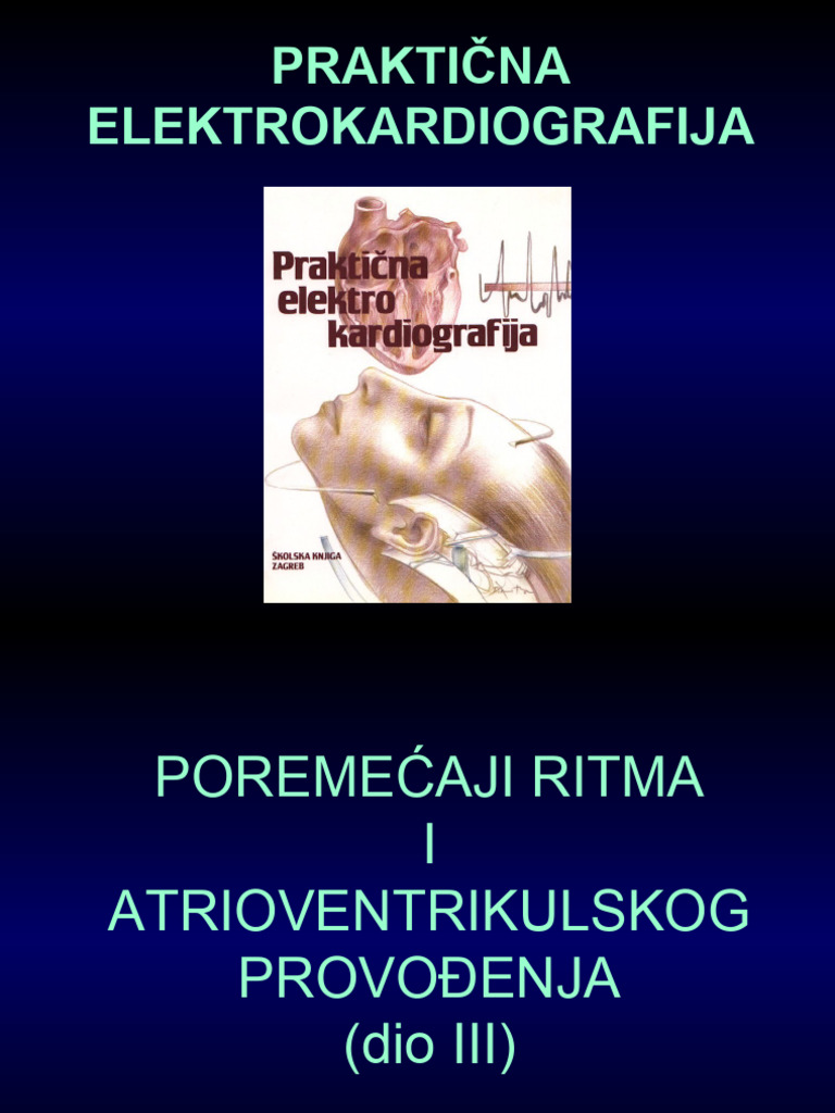 EKG Blokovi Srca AV, IV, SA | PDF