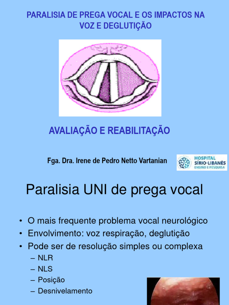 APOSTILA - Paralisia de Pregas Vocais X Voz e Deglutição - Irene Netto ...
