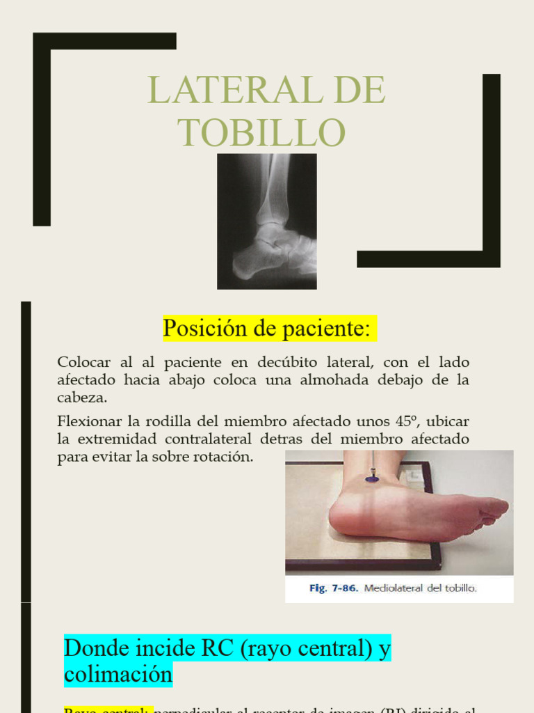 Proyeccion Lateral de Tobillo | PDF