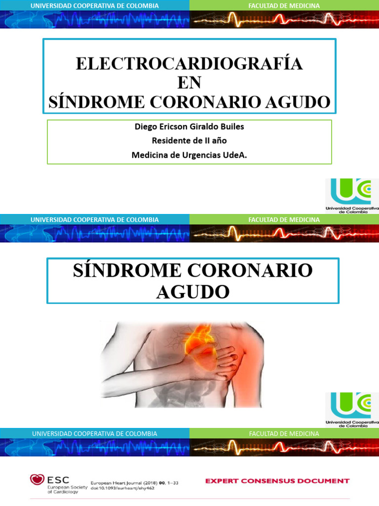 SCA y ECG | PDF | Electrocardiografia | Infarto de miocardio