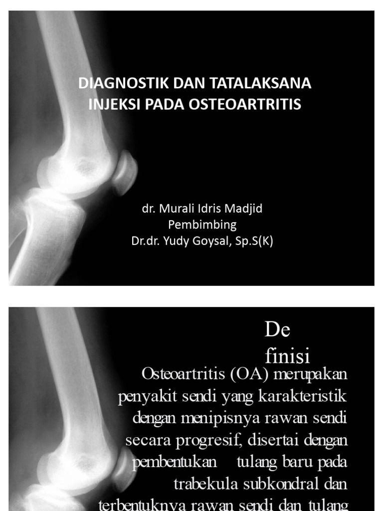 Oa Genu | PDF