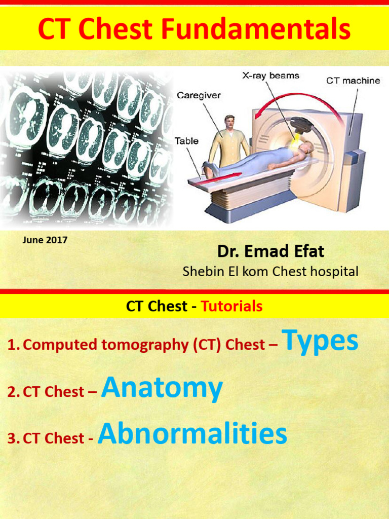 Emad Efat Chest CT Best | PDF | Lung | Ct Scan