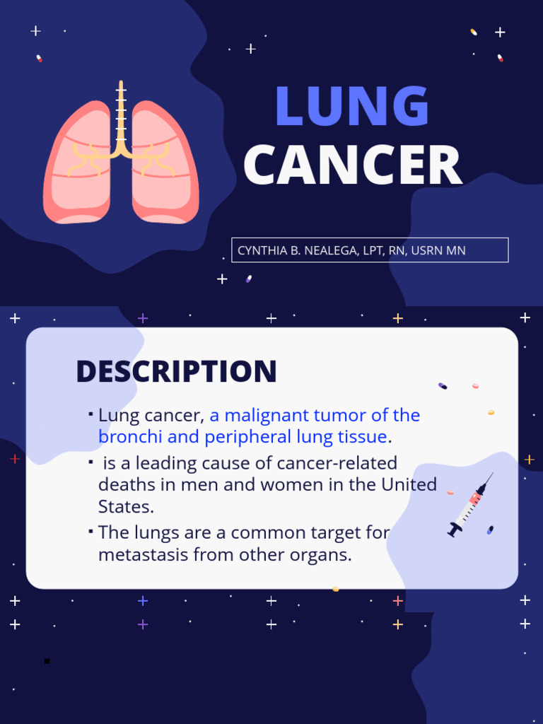 Lung Cancer Edited | PDF | Lung Cancer | Metastasis