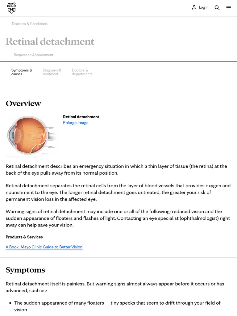 Retinal Detachment - Symptoms and Causes - Mayo Clinic | PDF | Retina ...