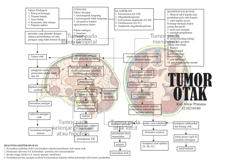 Mind Map Tumor Otak | PDF