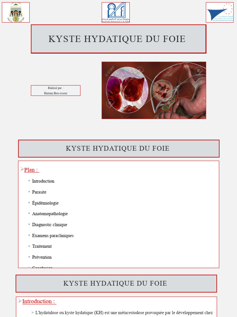 Kyste Hydatique HBS 2 | PDF | Médecine | Épidémiologie