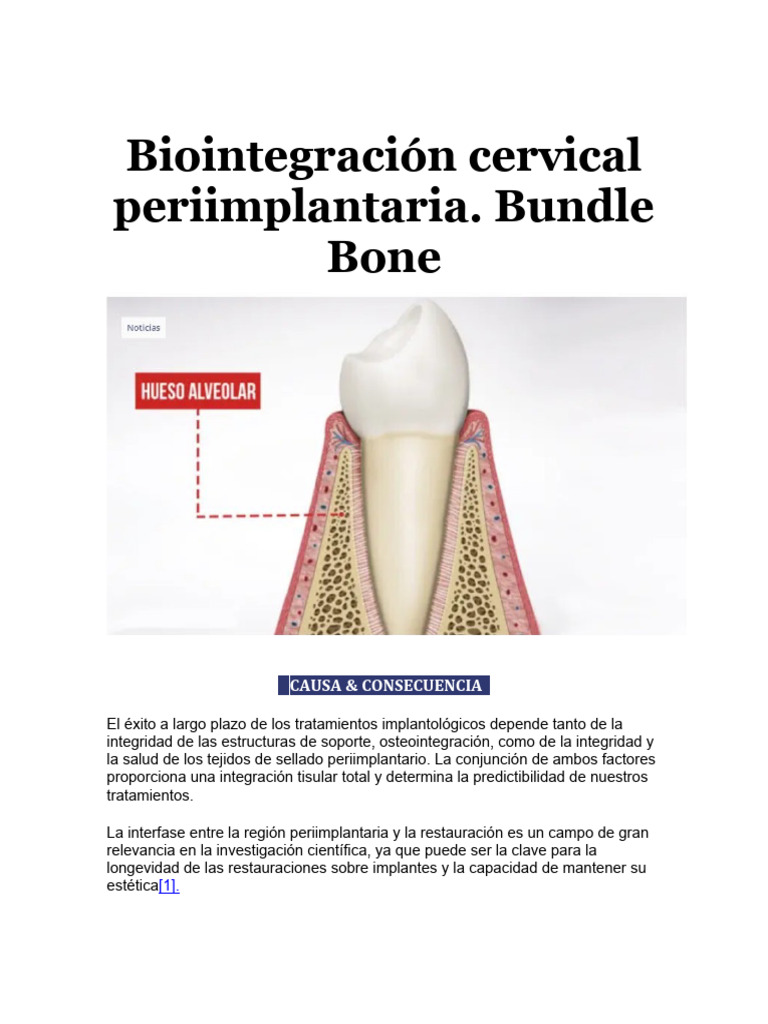 Biointegración Cervical Periimplantaria. BUNDLE BONE | PDF | Hueso | Dentadura postiza