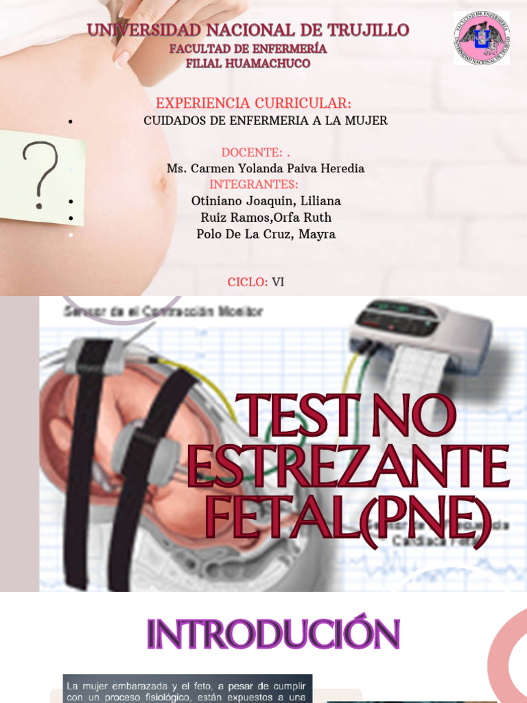 Monitoreo Fetal | PDF | El embarazo | Parto