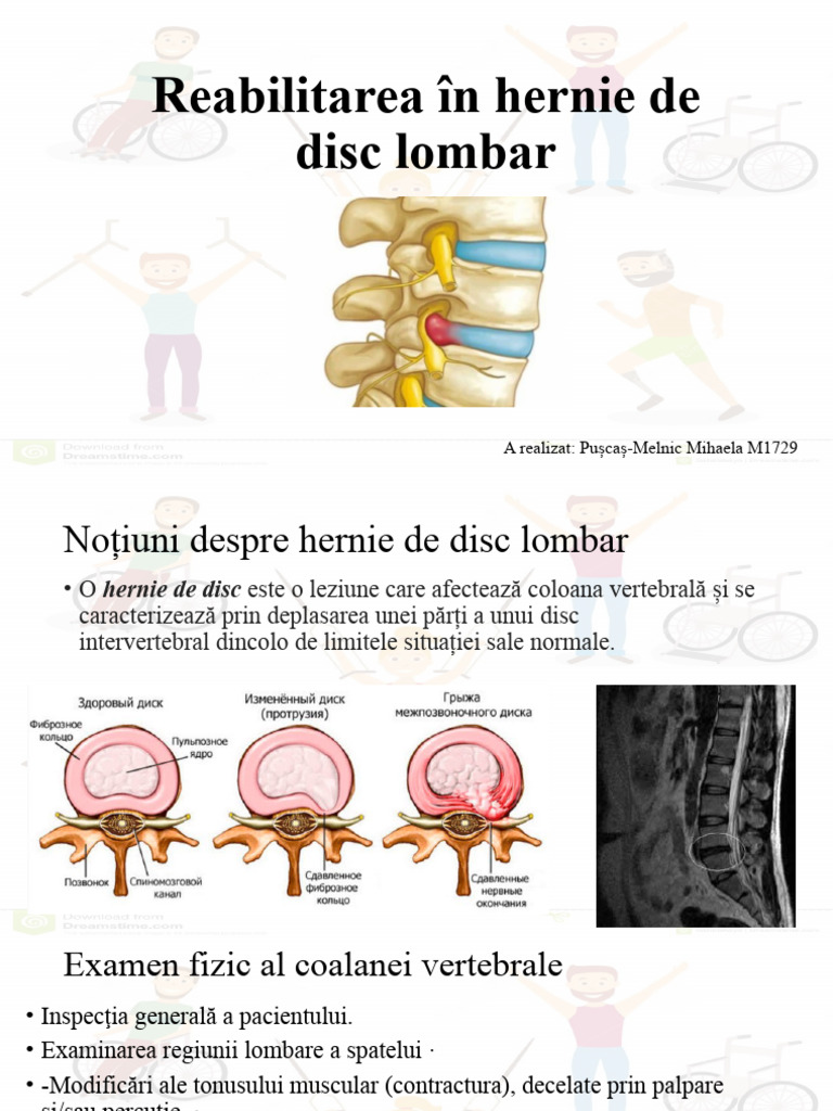 Reabilitarea În Hernie de Disc Lombar | PDF