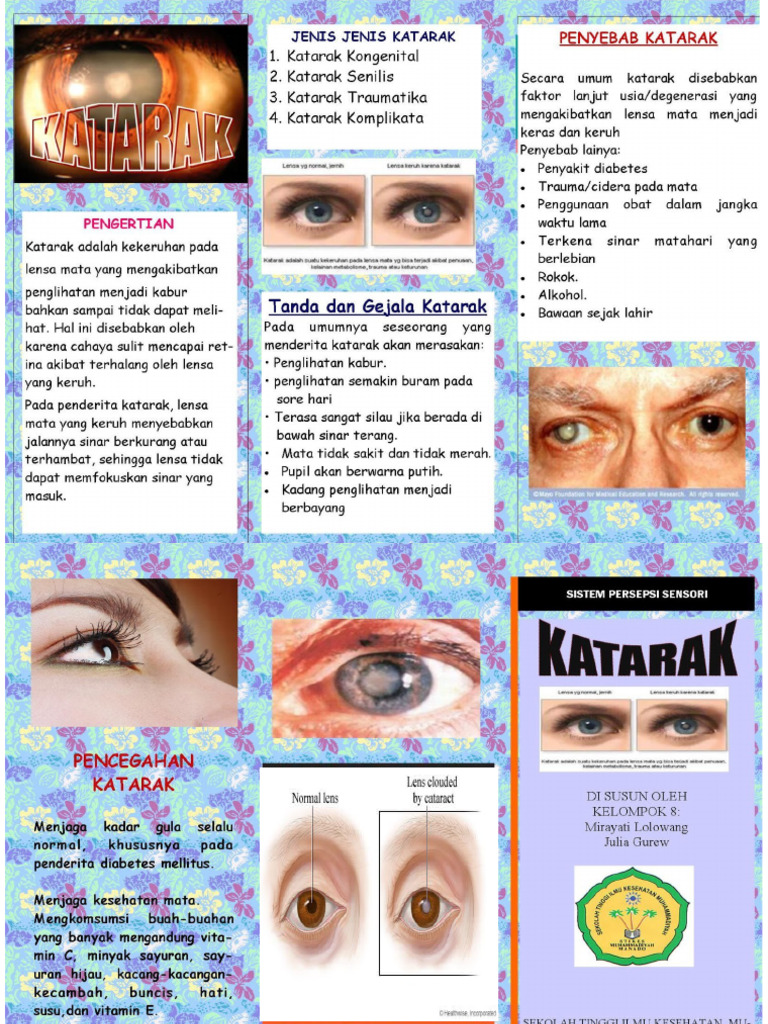Leaflet Katarak | PDF