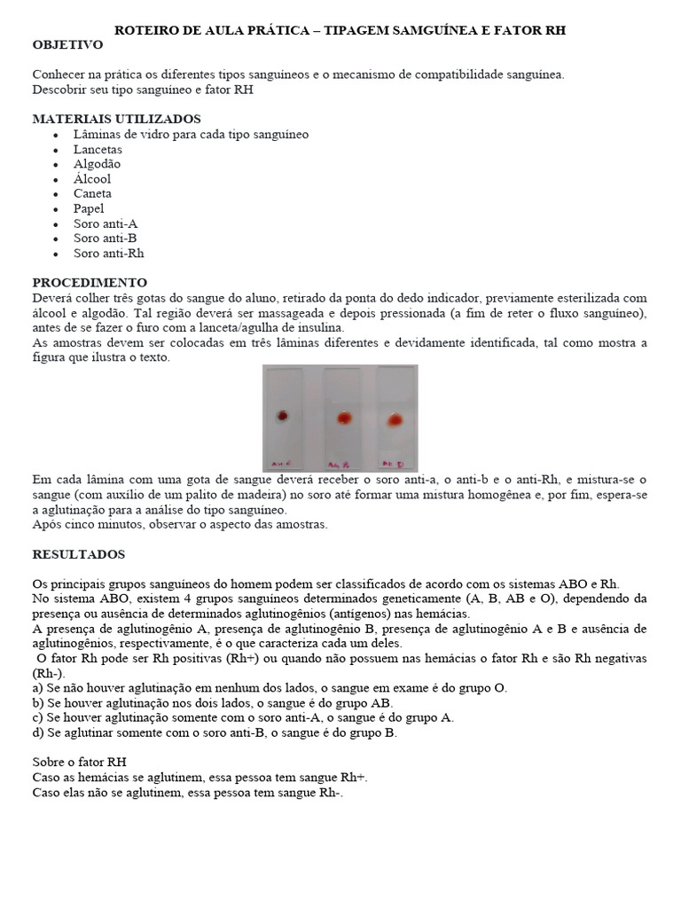 Roteiro de Aula Prática Tipagem Sanguinea | PDF