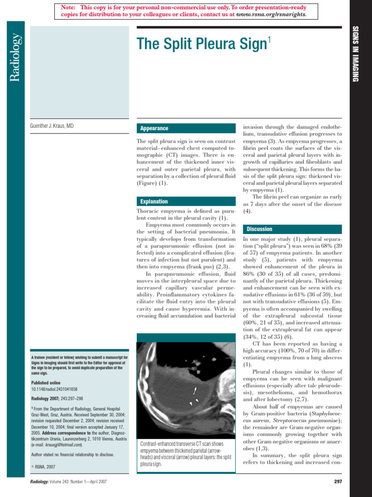 Split Pleura Sign | PDF | Clinical Medicine | Respiratory System