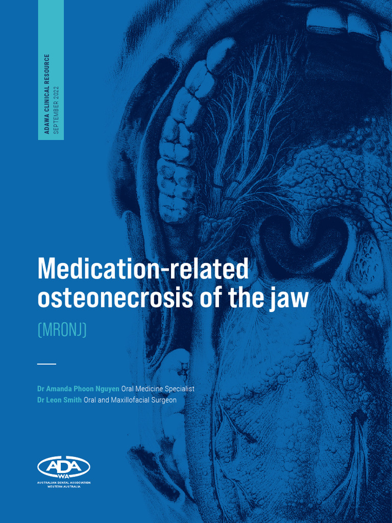 MRONJ | PDF | Diseases And Disorders | Health Sciences