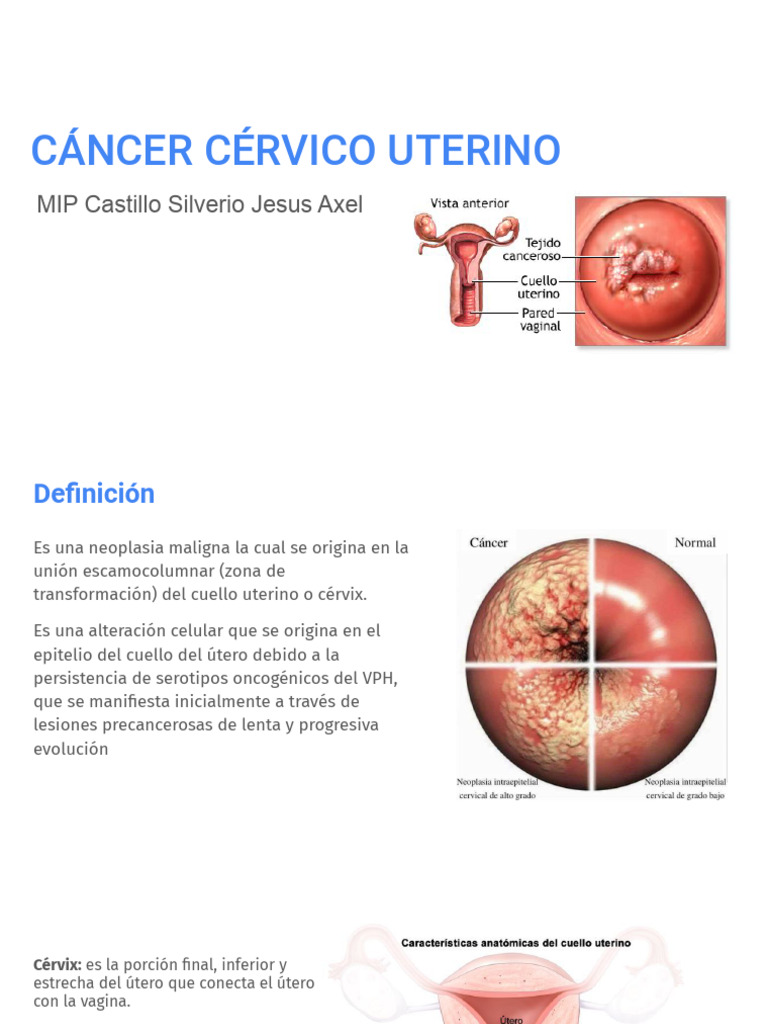 Cáncer Cérvico Uterino | PDF | Cáncer de cuello uterino | Cáncer
