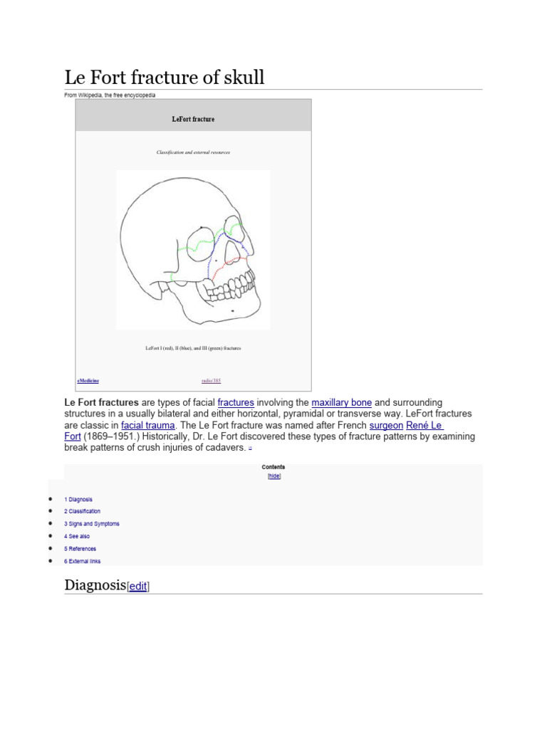 Le Fort Fracture of Skull | PDF | Face | Musculoskeletal System