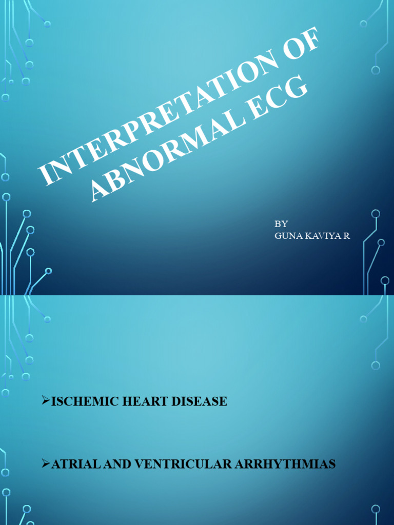 Stemi' | PDF | Electrocardiography | Myocardial Infarction