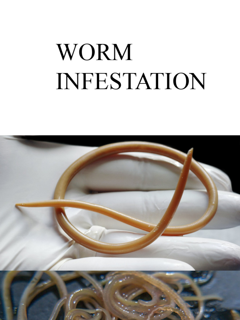 Worm Infestation | PDF | Microbiology | Medical Specialties