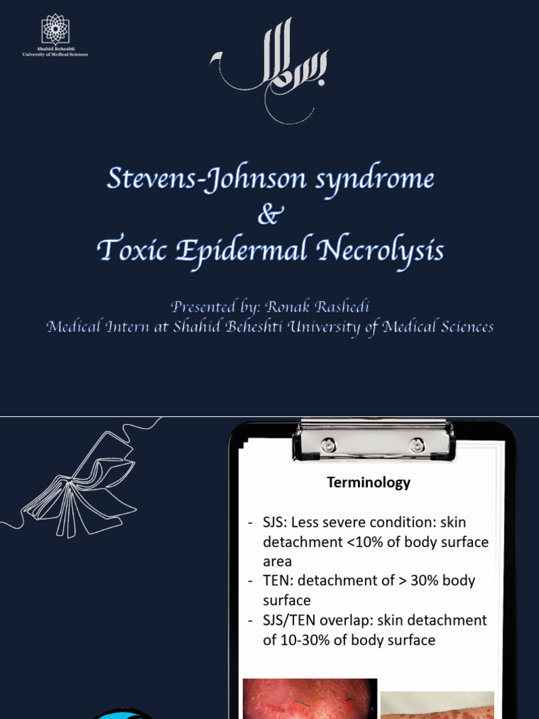 SJS&TEN | PDF | Natural Killer Cell | Cytotoxic T Cell