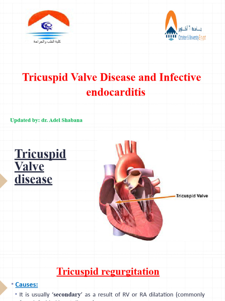 6-Tricuspid and Endocarditis | PDF