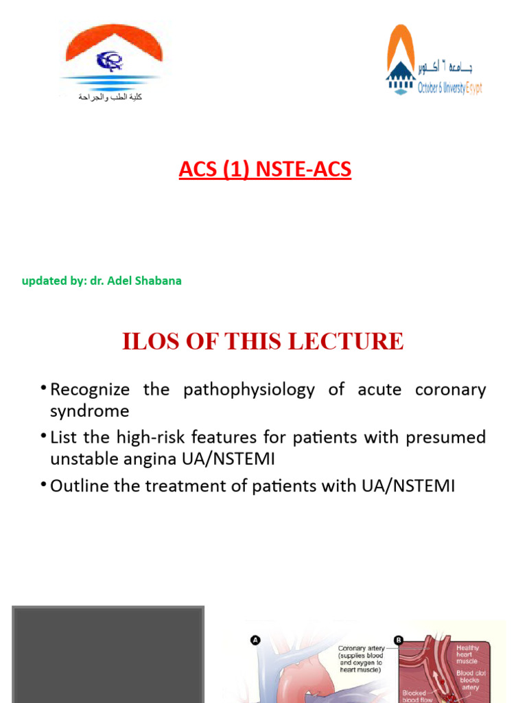 10-Acs1 Nstemi | PDF