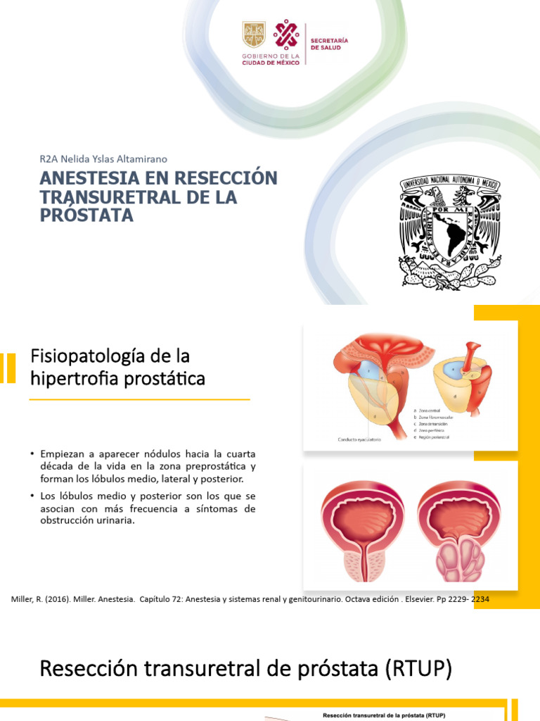 RTUP | PDF | Urología | Próstata