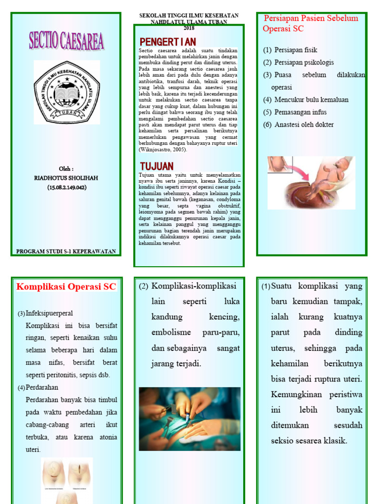 Panduan Lengkap Operasi Sectio Caesarea | PDF