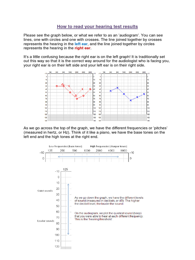 How To Read Your Hearing Test Results | PDF | Hearing Loss | Pitch (Music)
