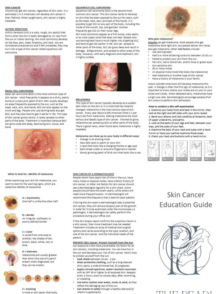 Skin Cancer Education Guide | PDF