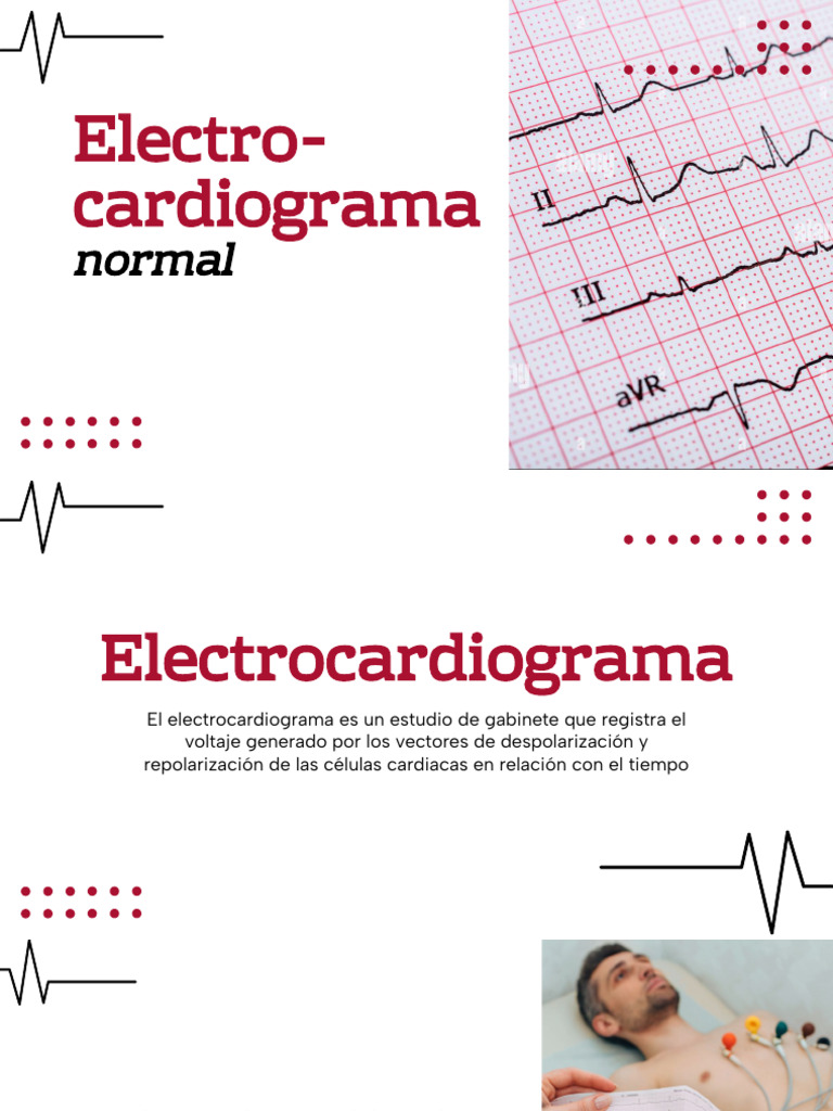 Electrocardiograma Normal | PDF