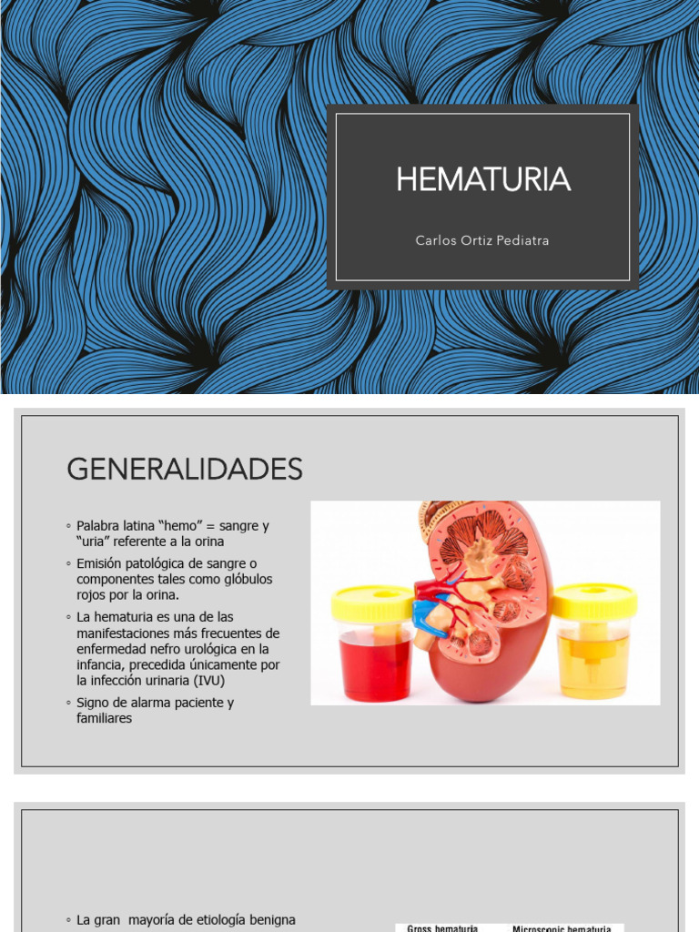 Hematuria en Niños: Diagnóstico y Clasificación | PDF | Especialidades ...