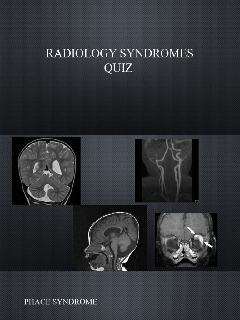 Radiology Syndrome Quiz | PDF | Vein | Uterus