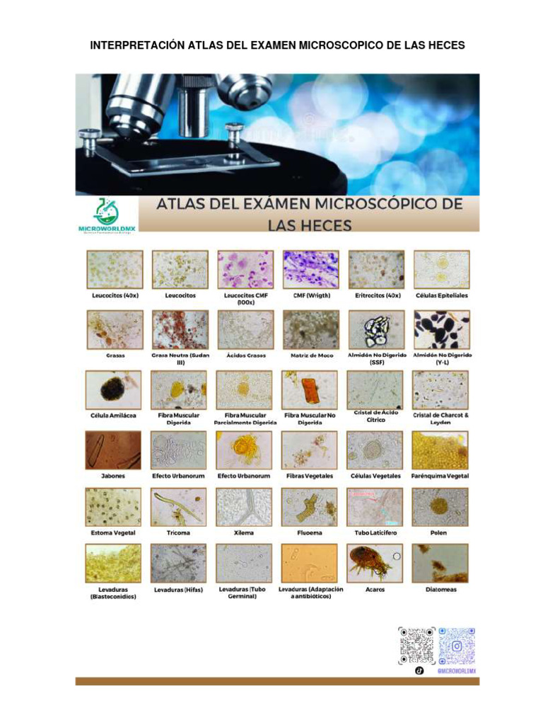 Interpretacion de Examen Microscopico de Las Heces | PDF | Plantas | Digestión